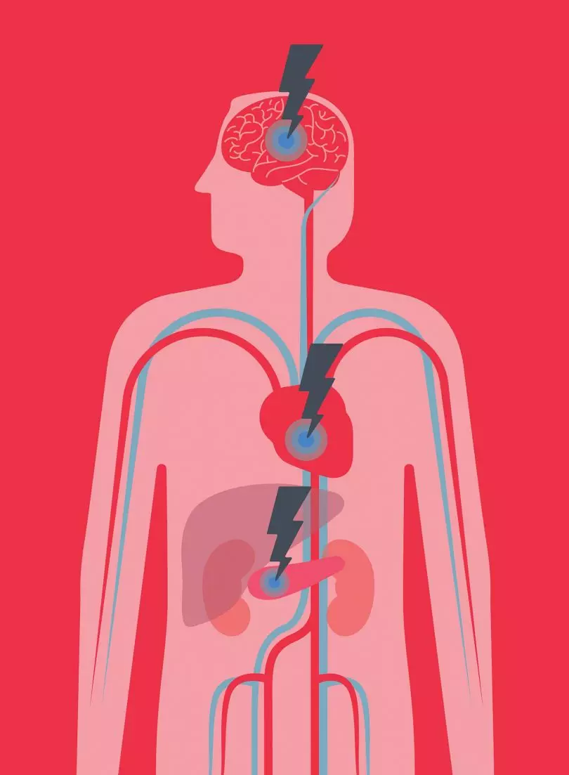 En illustration för British Heart Foundation, som visar några av effekterna av diabetes på kroppen © Andrew Baker